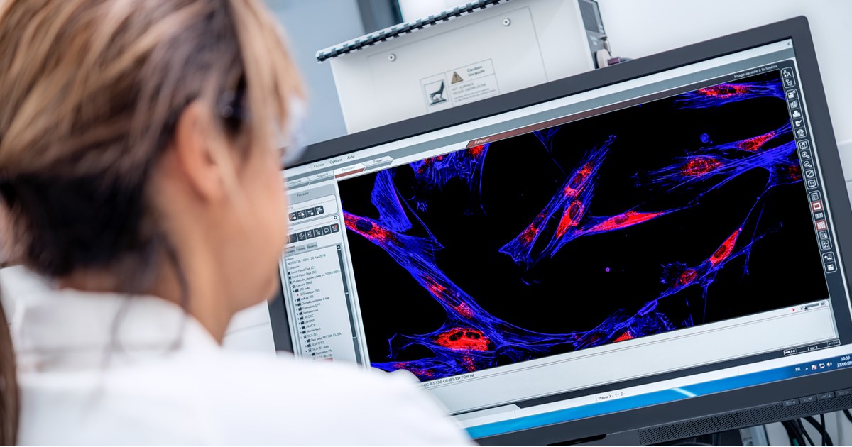 Custom conjugation & labeling service | AnaSpec