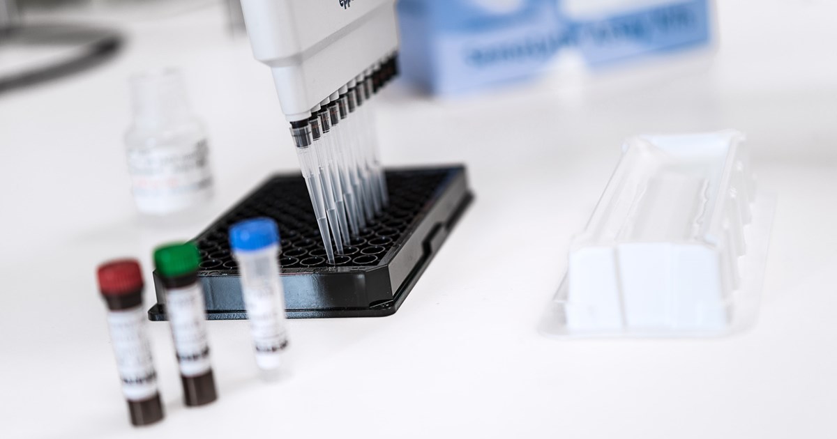 Assay kits for Reporter Enzymes | Anaspec