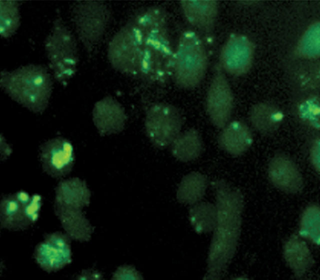 Fluorescent labeled custom peptides | AnaSpec