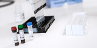 Neuroscience peptides | AnaSpec